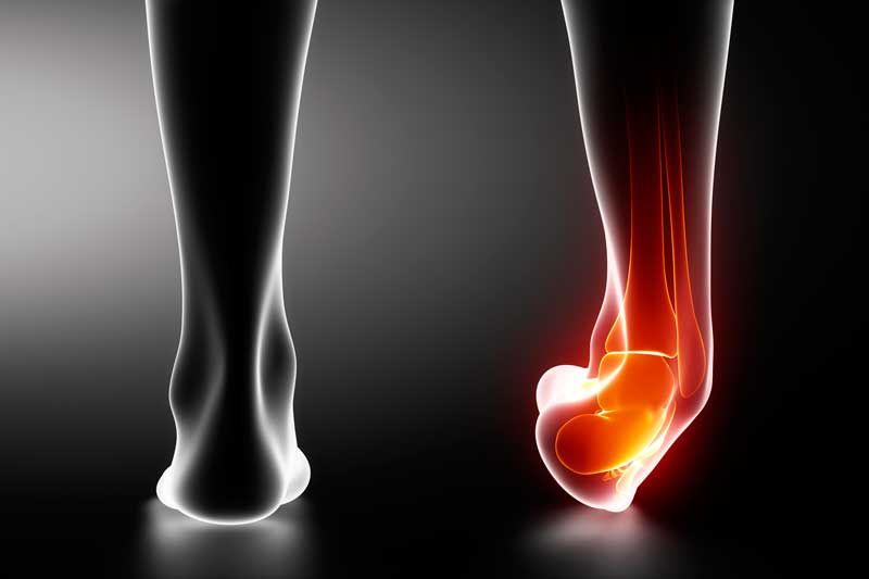 Ankle Injury Arthroscopy| Joint Arthroscopy (Key Hole Surgery) Bangalore
